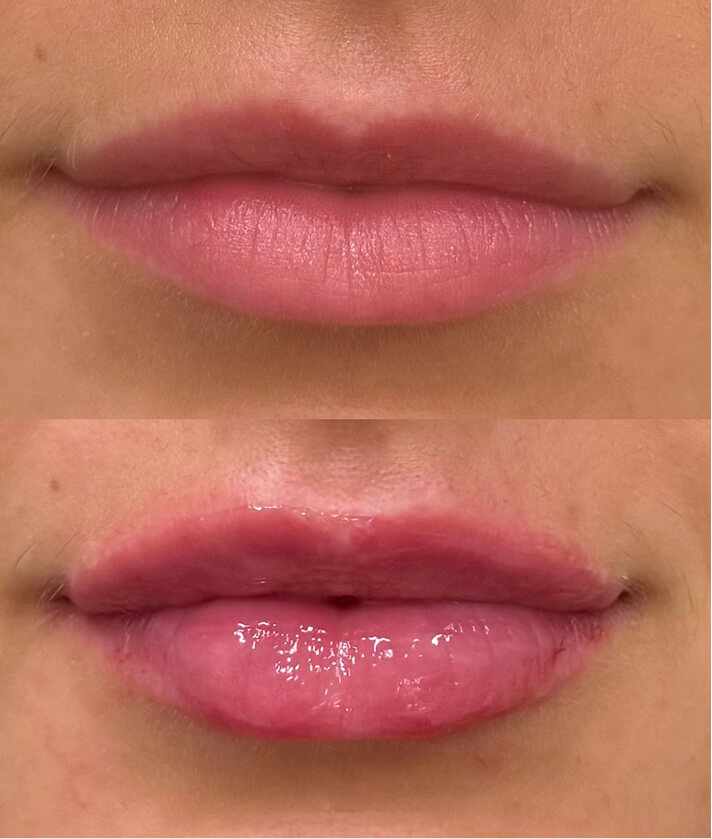 Smoother, Brighter & Healthier Skin in Vancouver | Skinnovate